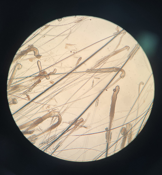 Visita dermatologica - Dott.ssa Irina Matricoti